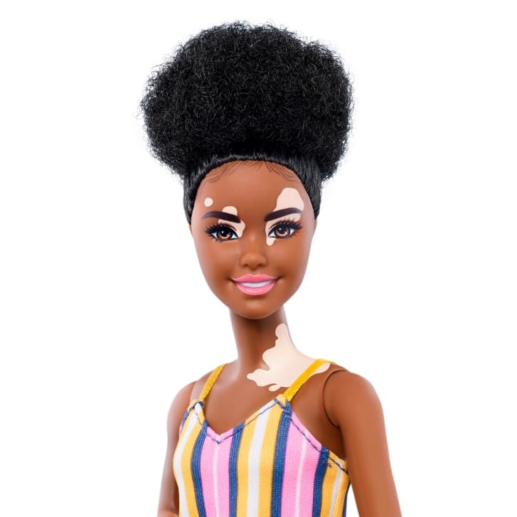 barbie-vitiligo-sin-cabello-muncc83ecas-diversidad2.jpg