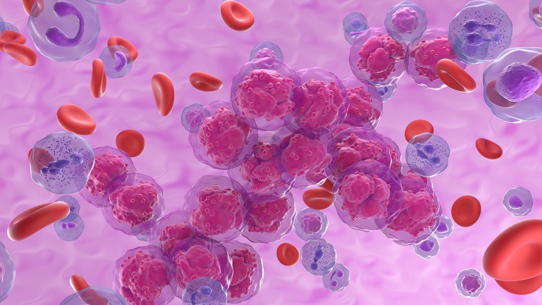 Study Shows Advance of Test for Early Cancer Detection – Archyde