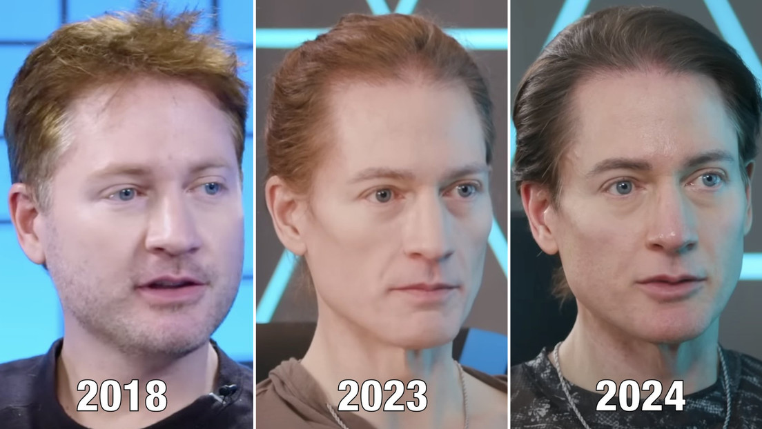 La última foto es de este año, y la apariencia física del magnate ...