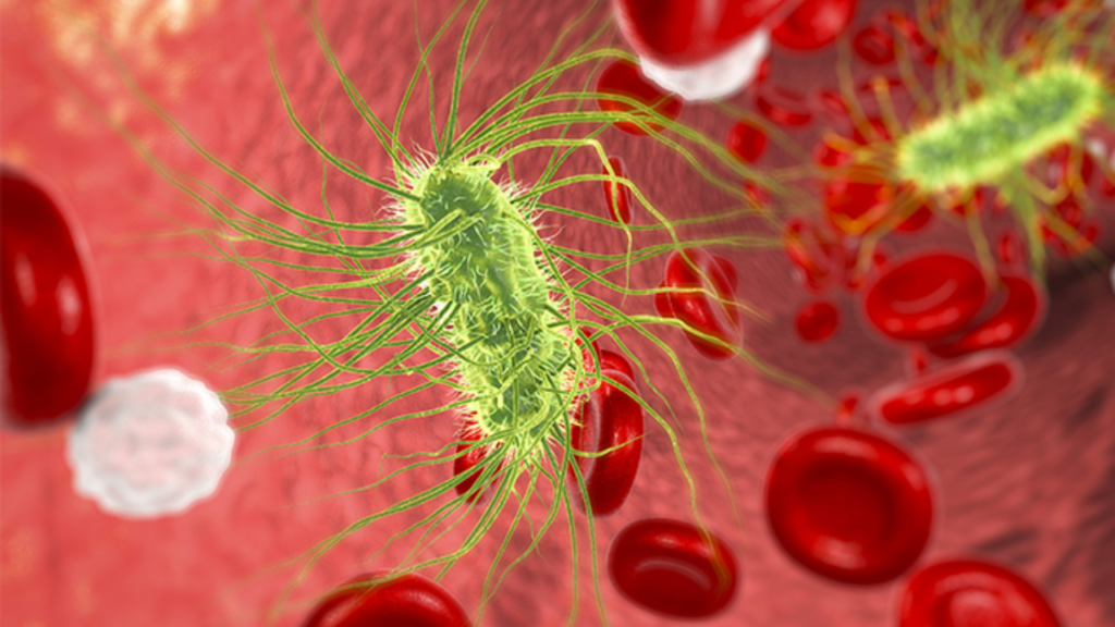 Sepsis.png