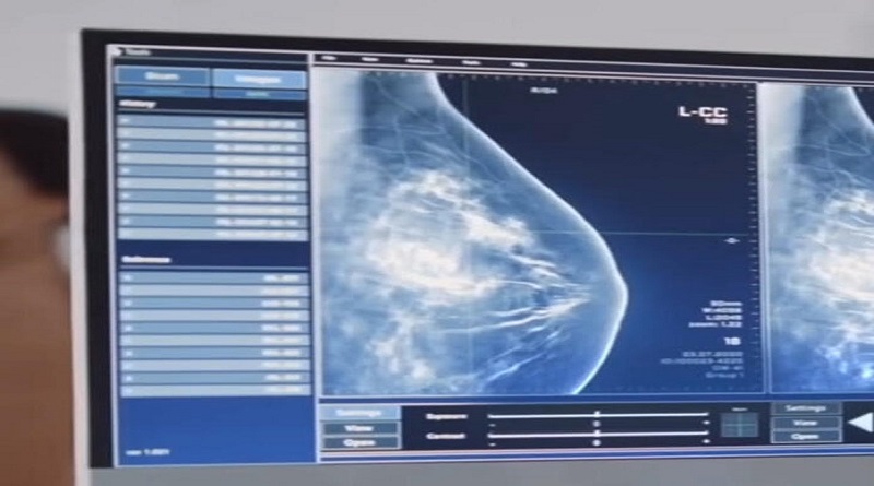 Venezuela-cuenta-con-software-que-detecta-el-cancer-de-mama-y-tiroides.jpeg