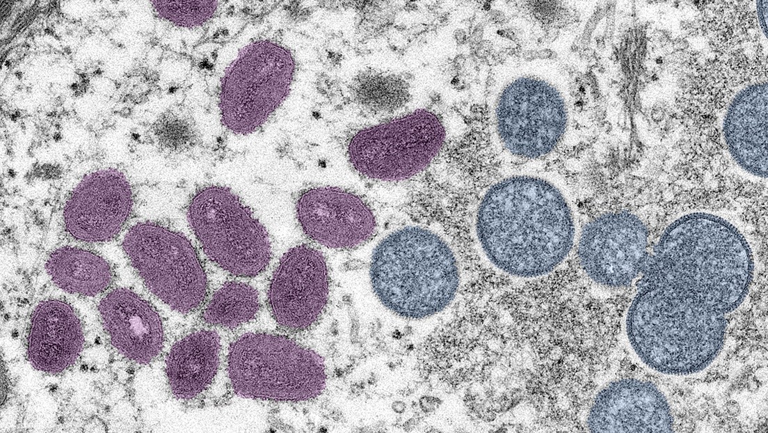 viruela-del-mono-virus.jpeg